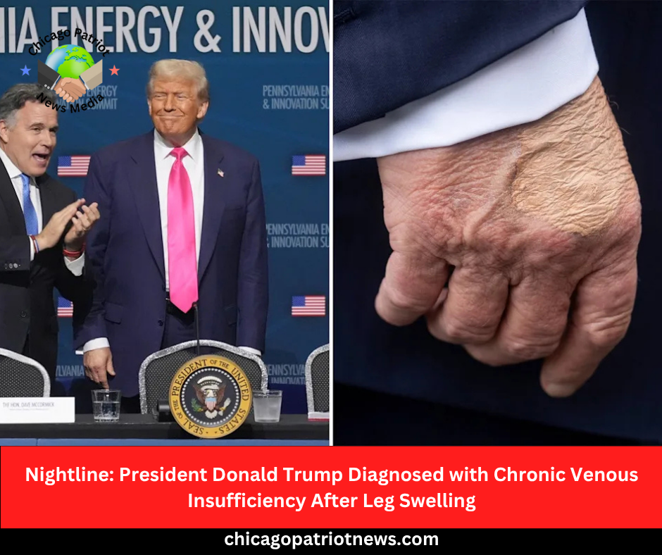 Nightline: President Donald Trump Diagnosed with Chronic Venous ...